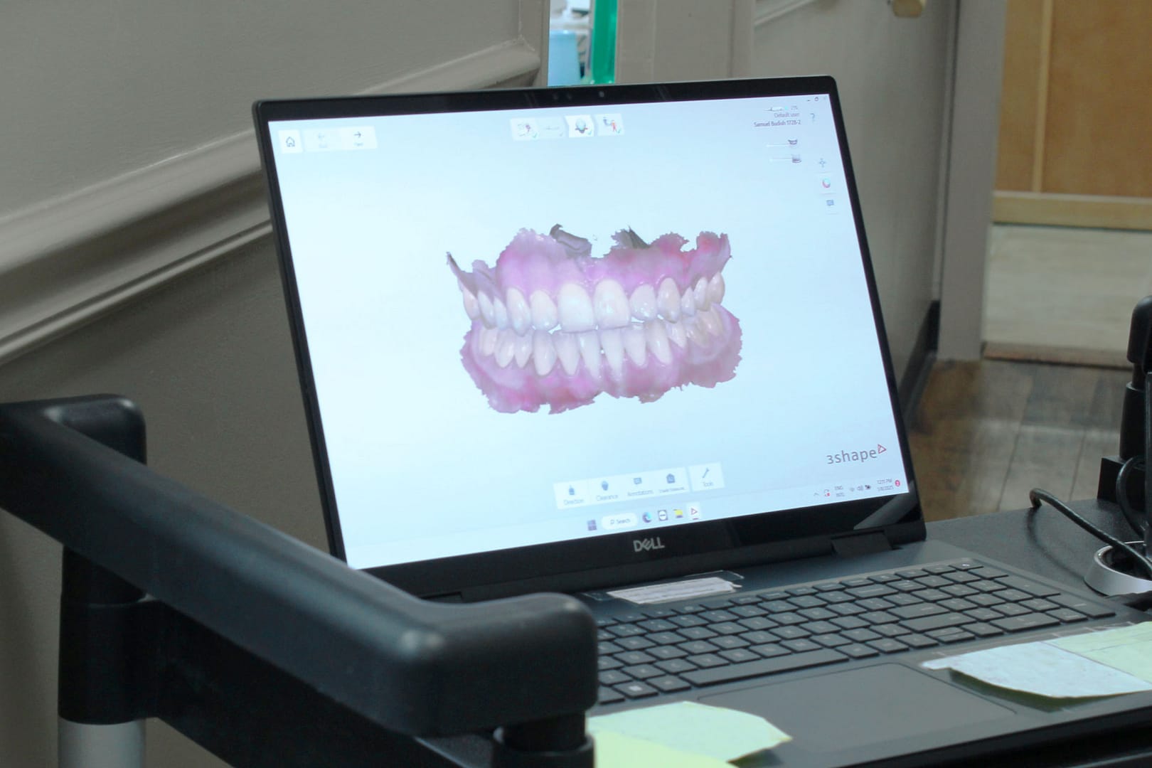 Restorative Dentistry — Hybrid Dentures — Dental Implants