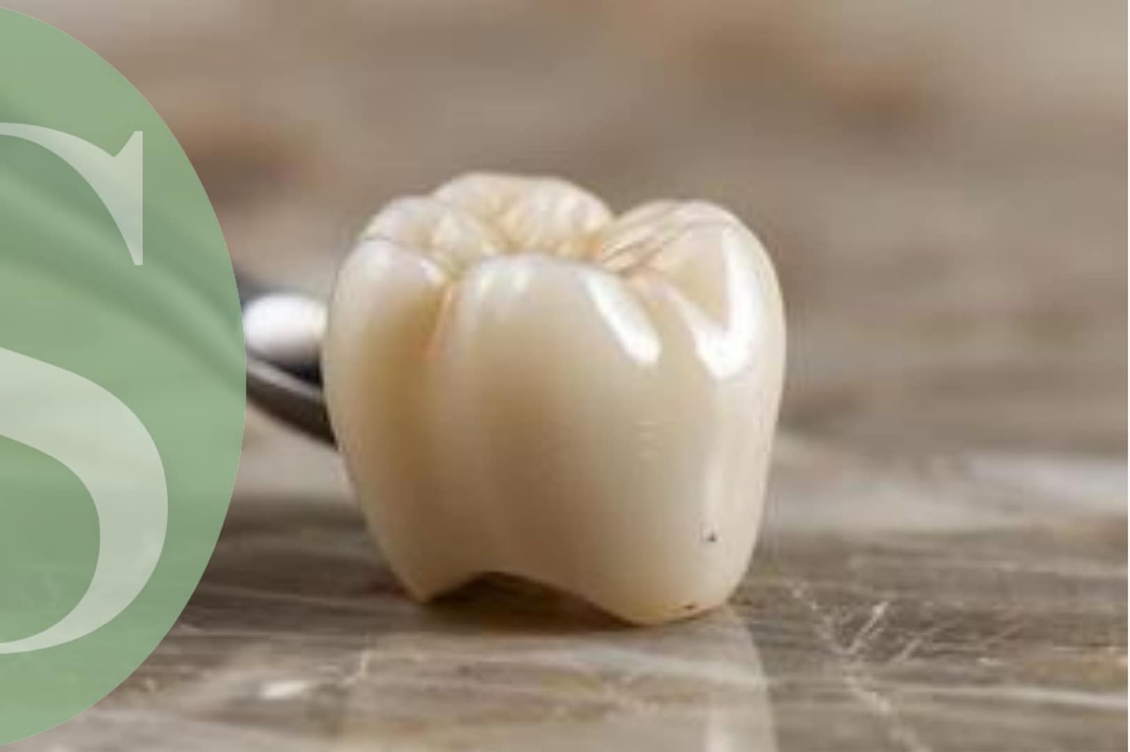 Learn How Decay Strikes Again: Cavities Under A Dental Crown
