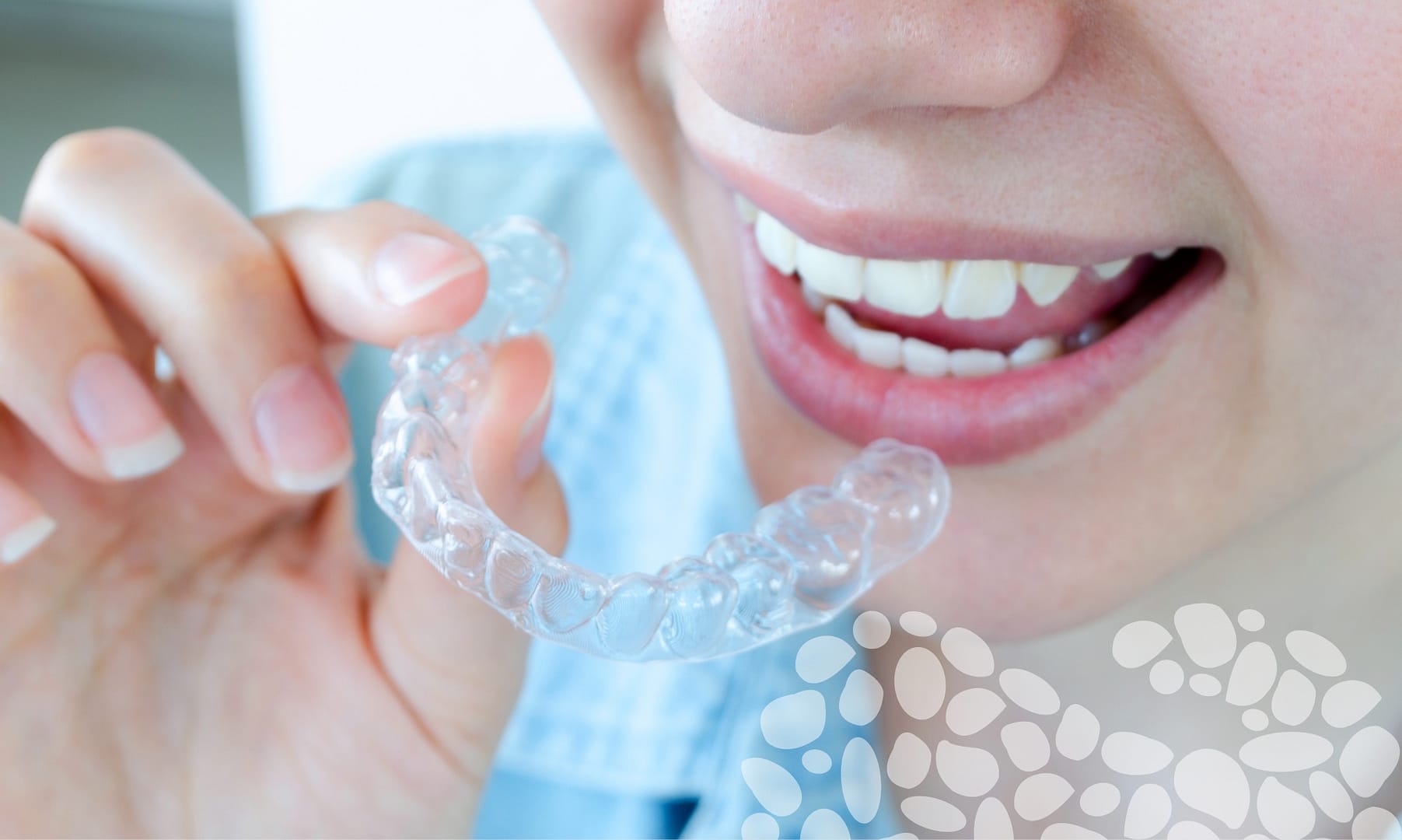 SureSmile Clear Aligners: A Way to Straighten Your Teeth