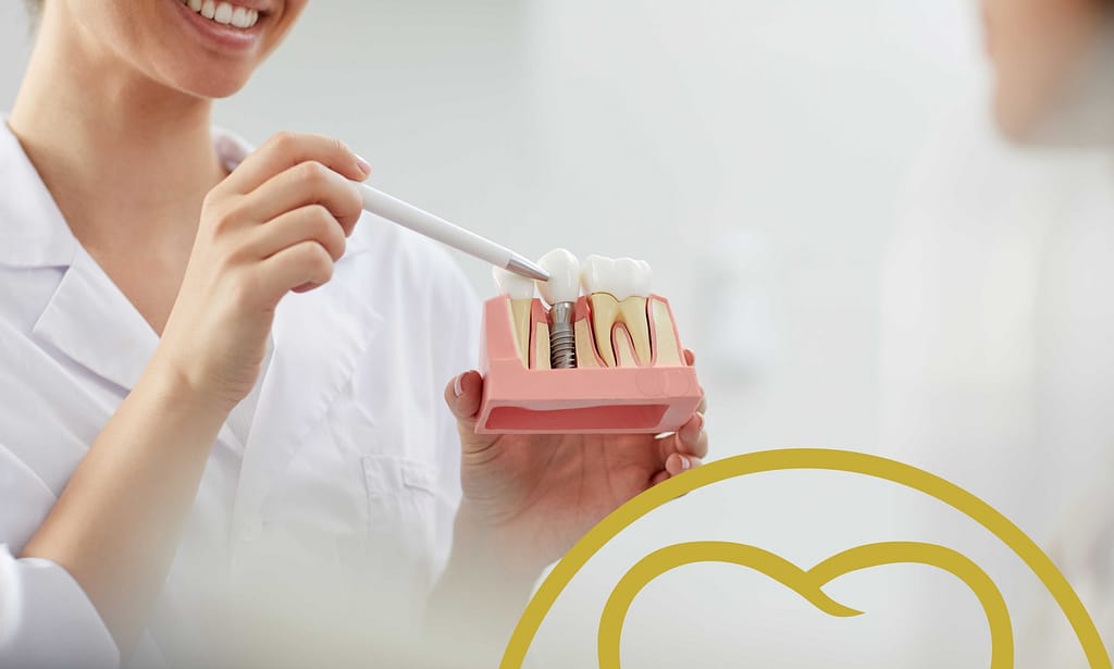 Dental Implants vs. Partial Dentures: Which One to Choose?