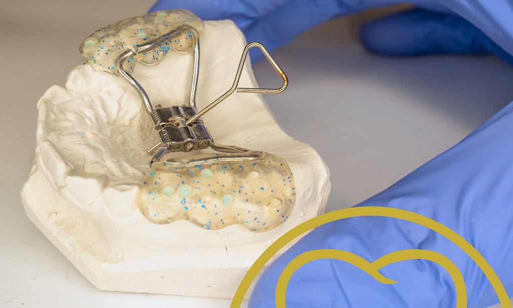 Palatal Expanders in Orthodontics: 5 Things You Need to Know