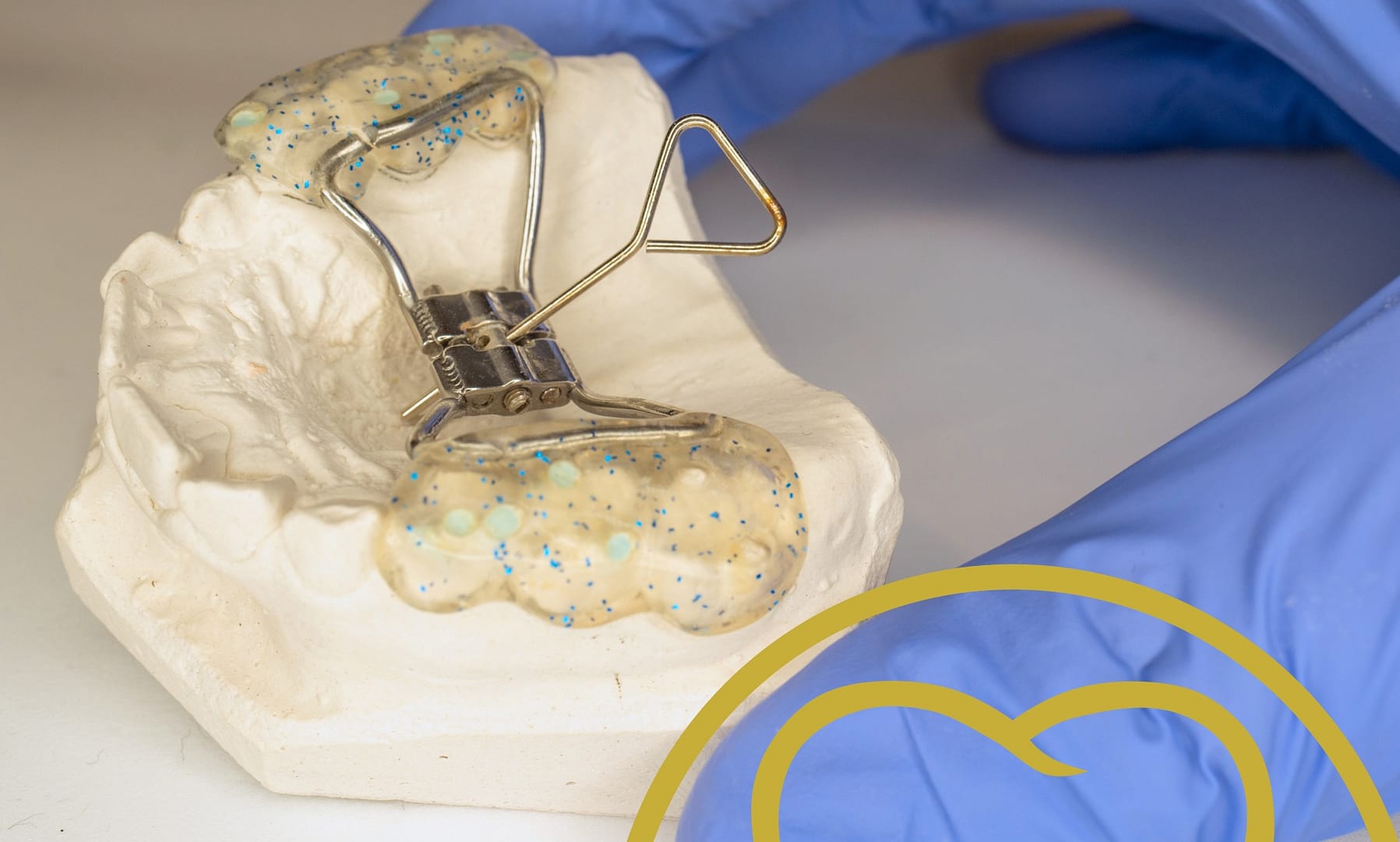 Palatal Expanders in Orthodontics: 5 Things You Need to Know