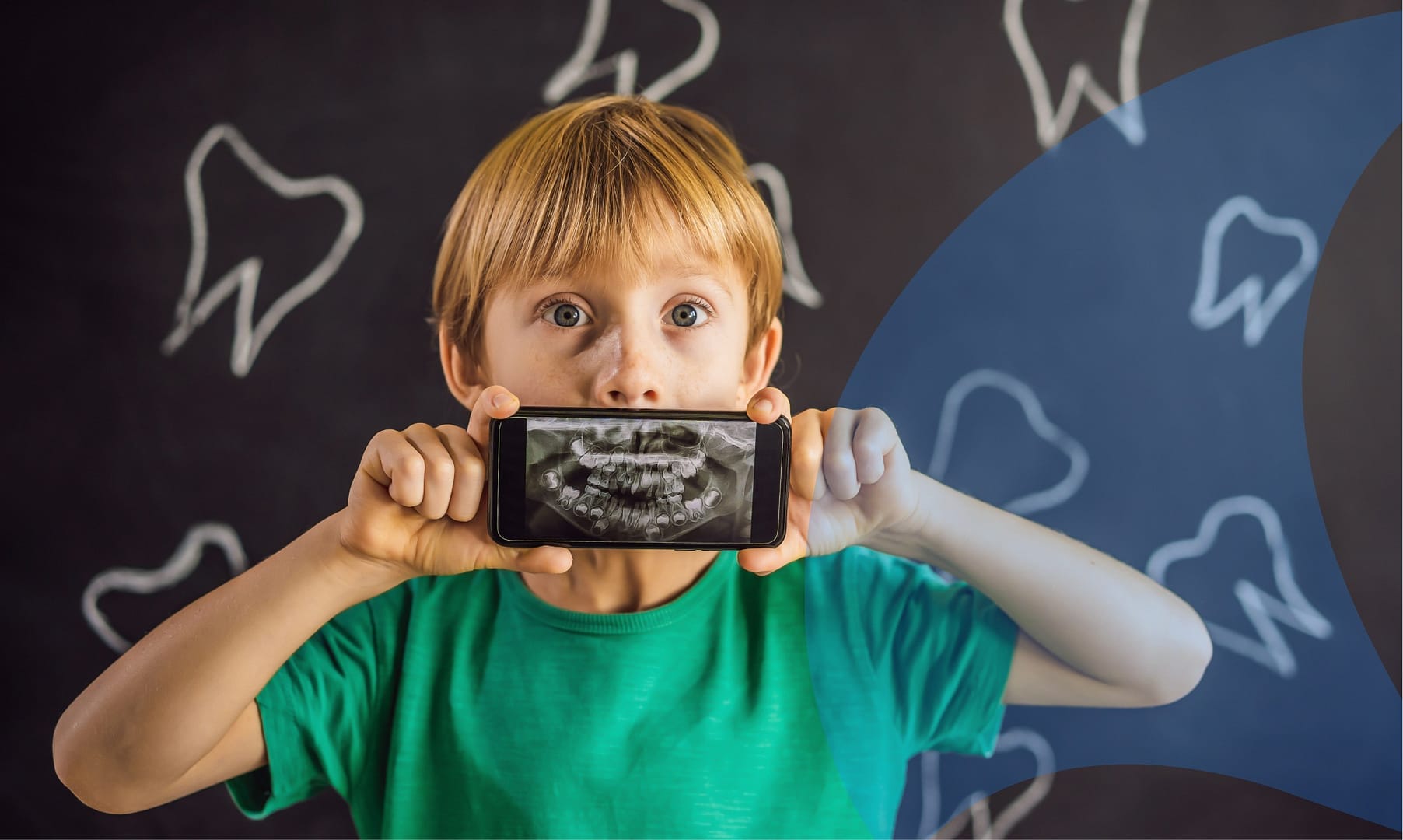 Tiny Teeth: Do Baby Teeth Really Need Dental X-Rays?