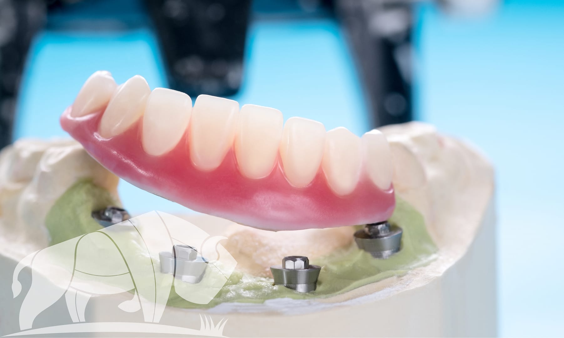 Discover Your Prosthodontic Tooth Replacement Options