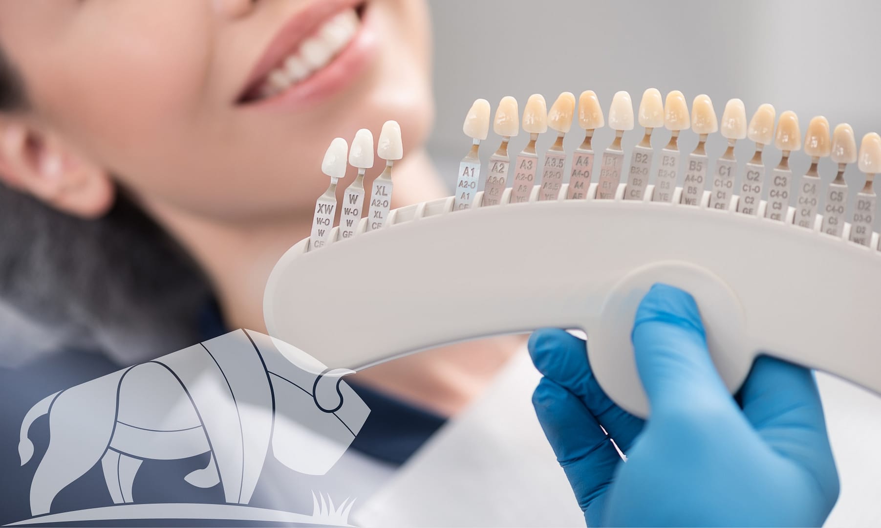 Dental Crowns Blend In: We Match Your Natural Tooth Color