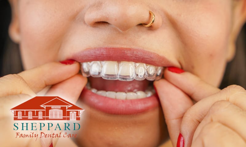 Here's What to Expect When You Select ClearCorrect