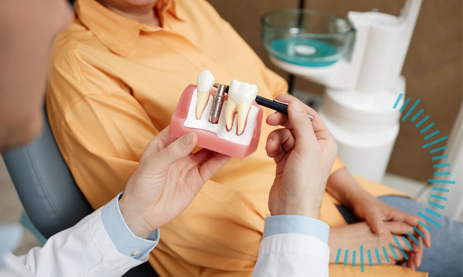 Dental Implants vs. Dentures: 5 Key Considerations