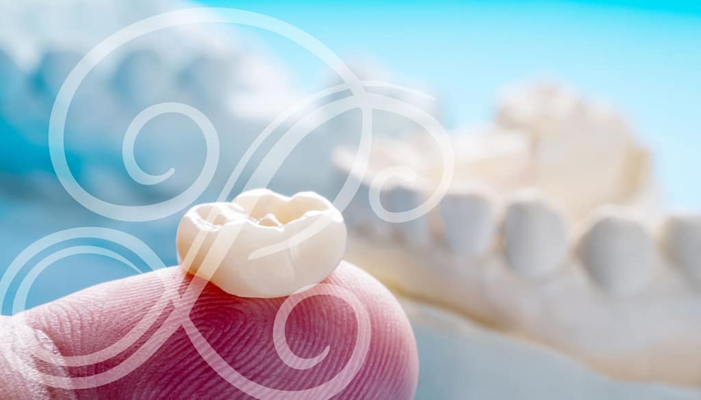 Smile's Secret Weapon: When and Why Dental Crowns Matter