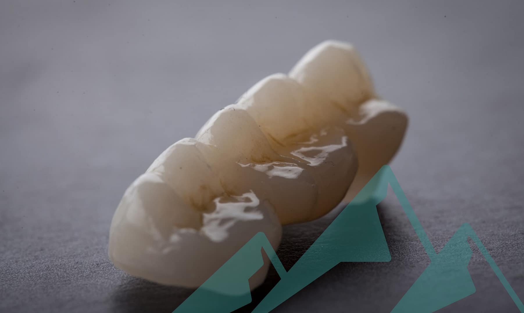 What's an E.max Crown, and Why Do I Need One?