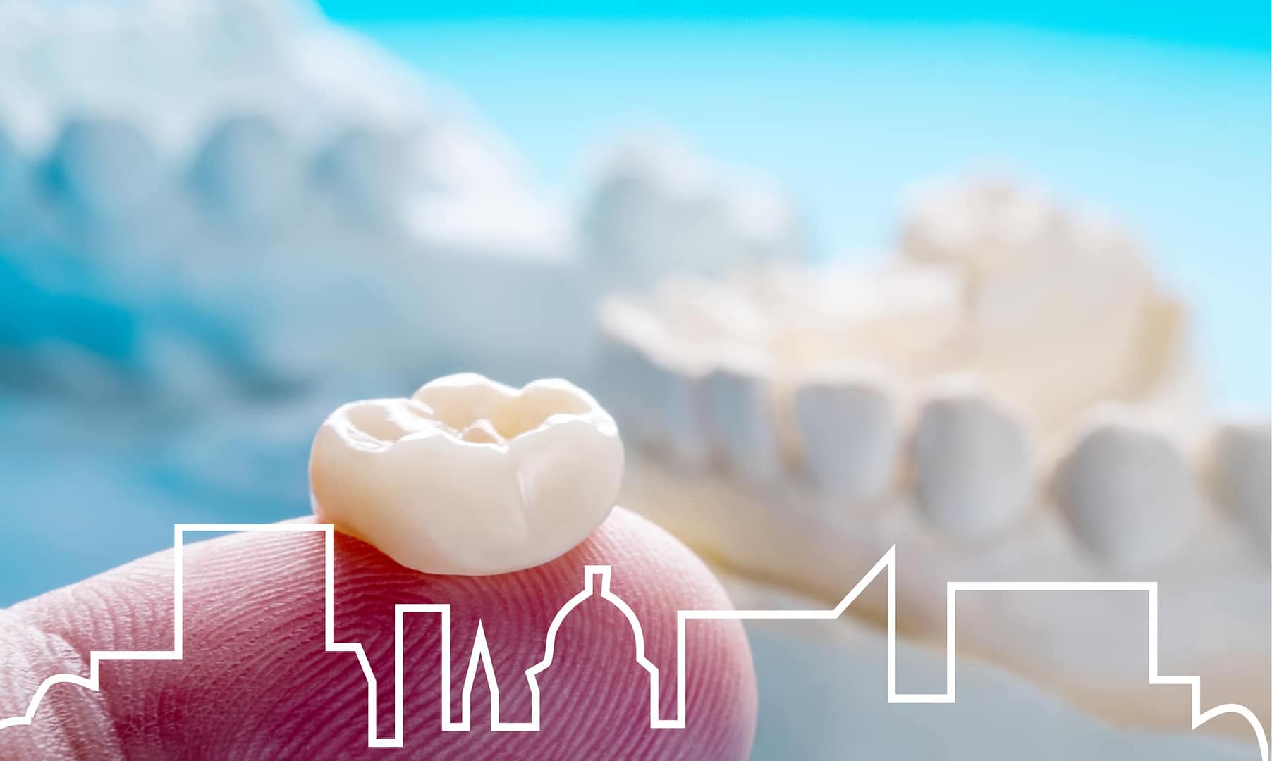A Smile Makeover in a Flash: The Magic of CEREC Same Day Crowns at ...