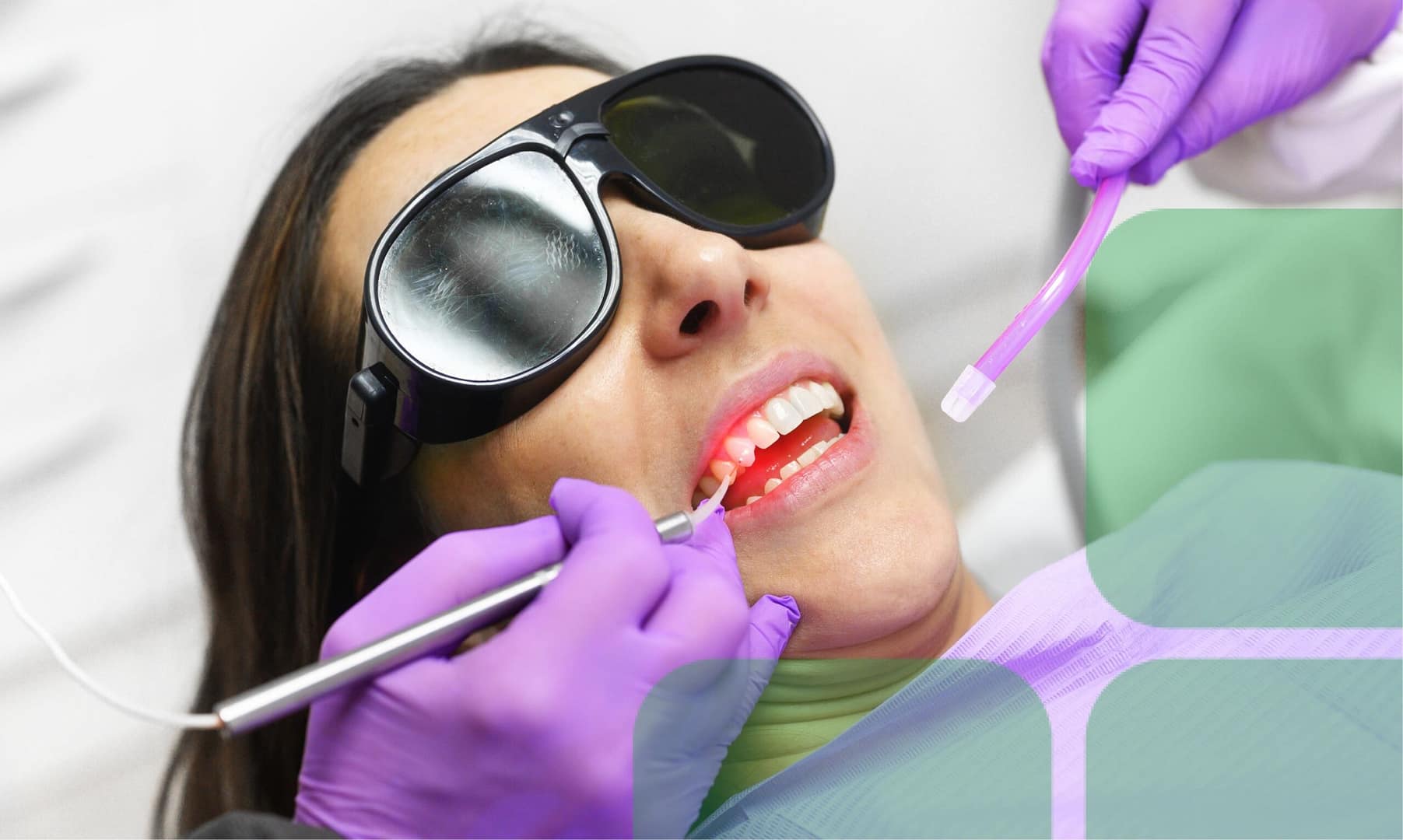 What is a Soft Tissue Laser and How Can it Help My Smile?