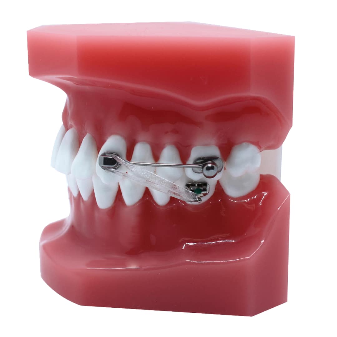 D2 Appliance - Ortho Arch