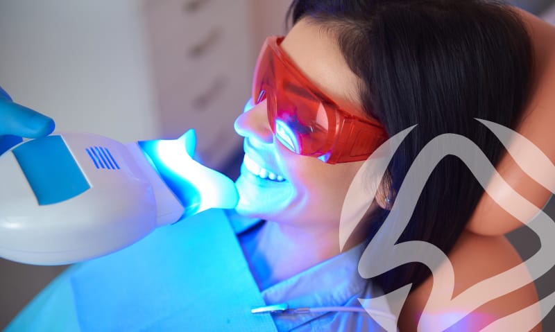 Professional Teeth Bleaching - Oxley Comprehensive Dentistry