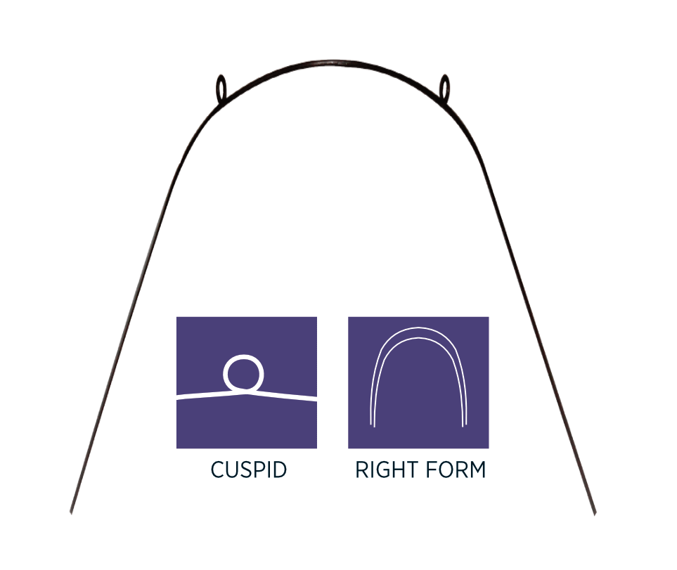 A.J. Wilcock Vertical-Loop Retraction Arch - Ortho Arch